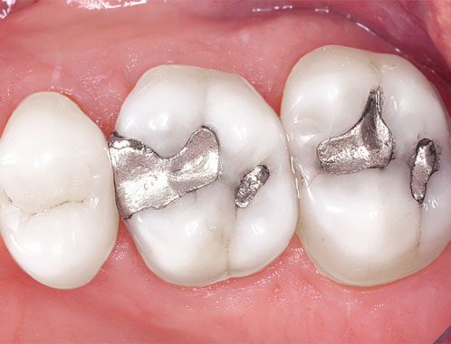 More Long-Standing Dental Health Myths, Busted! - ToothStars